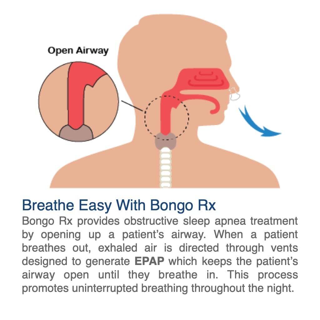 Starter Kit Bongo Rx Sleep Therapy Device - CPAP Alternative - Designed ...